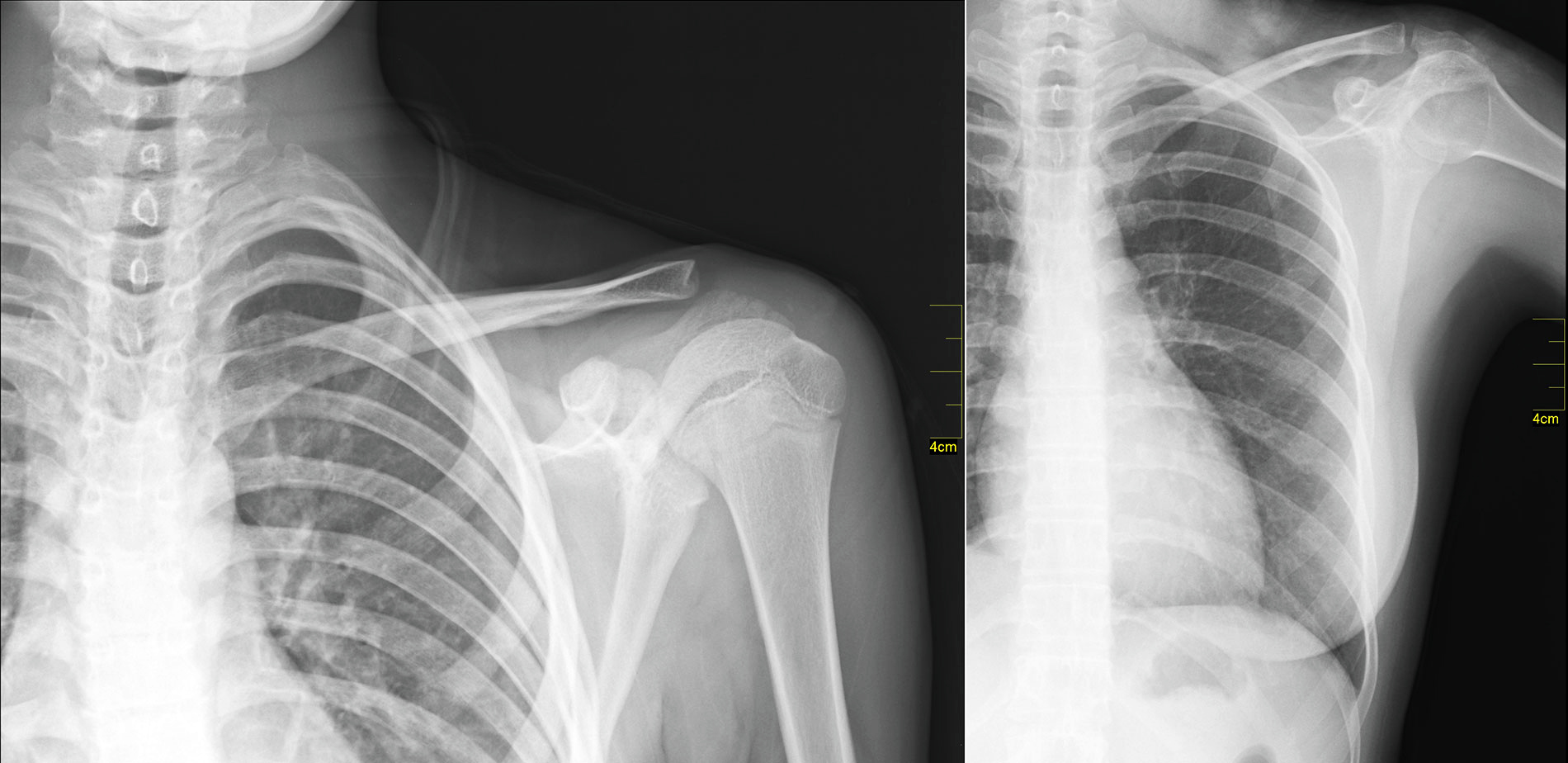 RIC Medical Imaging Students Secure 98% Job Placement Rate | Rhode ...